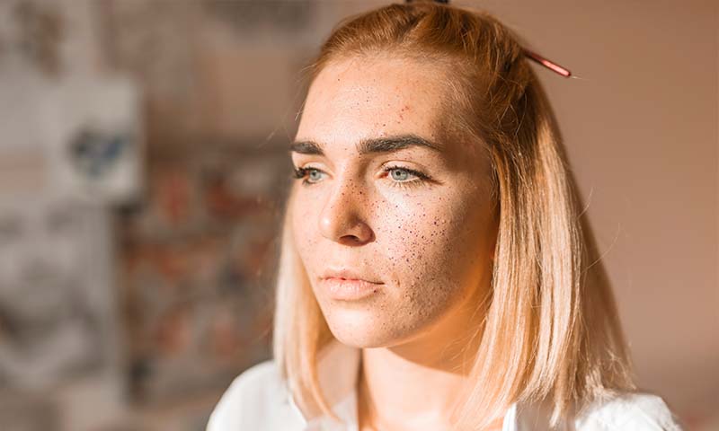 How to Improve Textured Skin | Tips to Improve Coarse Skin – BelleCôte ...